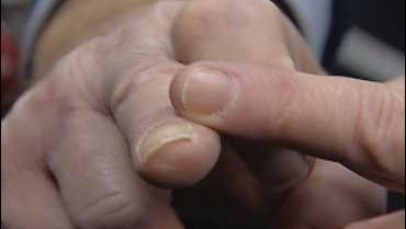 Medicine's Cutting Edge: Re-Growing Organs - CBS News