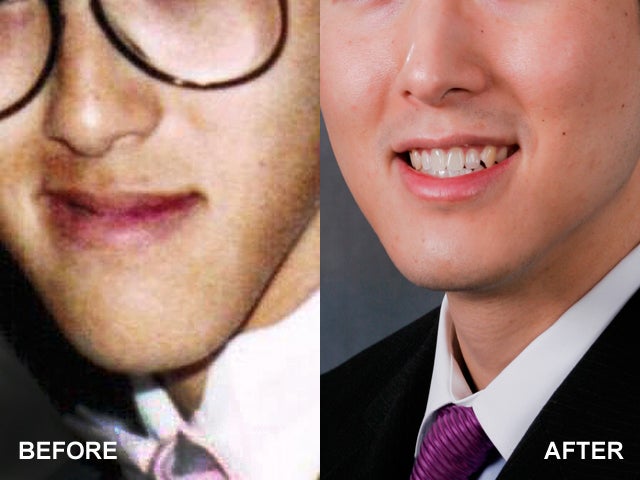 13 bizarre but popular plastic surgery procedures