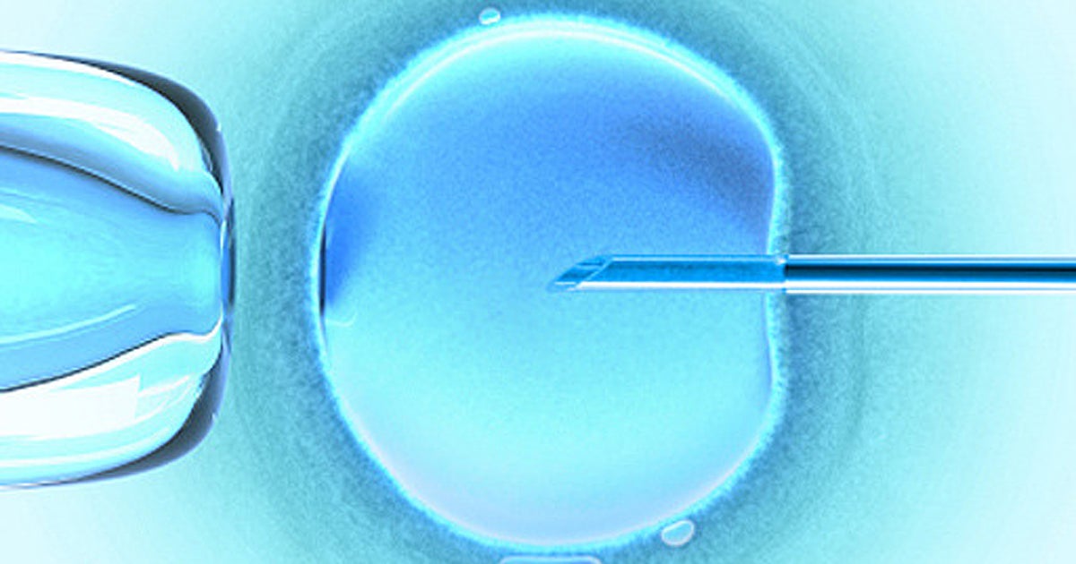 IVF first: Baby born with embryo selection from DNA screening - CBS News