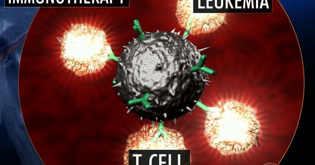 New weapon against cancer comes from patients' own bodies - CBS News