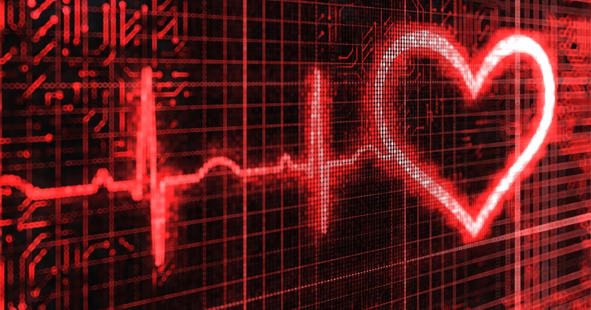 Why some women get broken-heart syndrome - CBS News