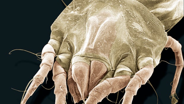 Dust mites hitch rides on international flights - CBS News