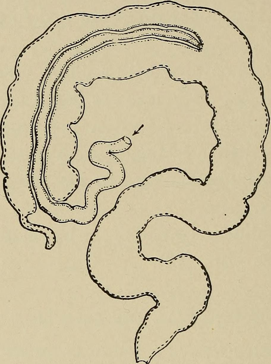 Medieval and ancient medicine we still use