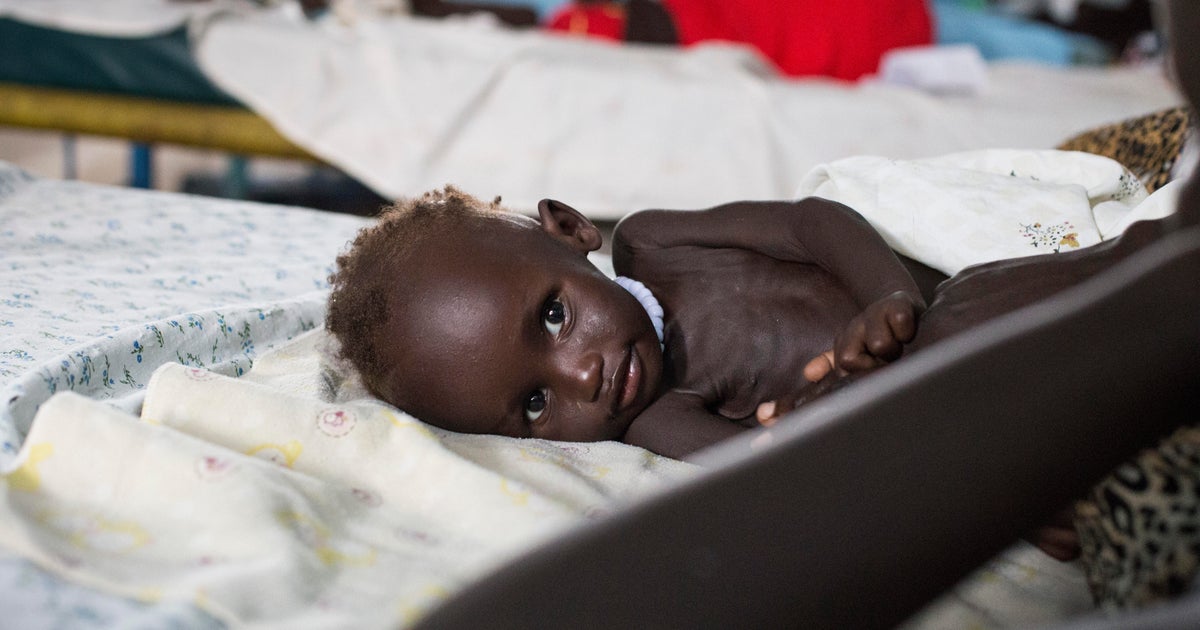Starving in South Sudan - CBS News