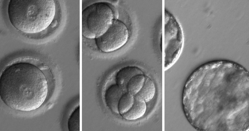 Gene editing fixes harmful mutation in human embryos - CBS News