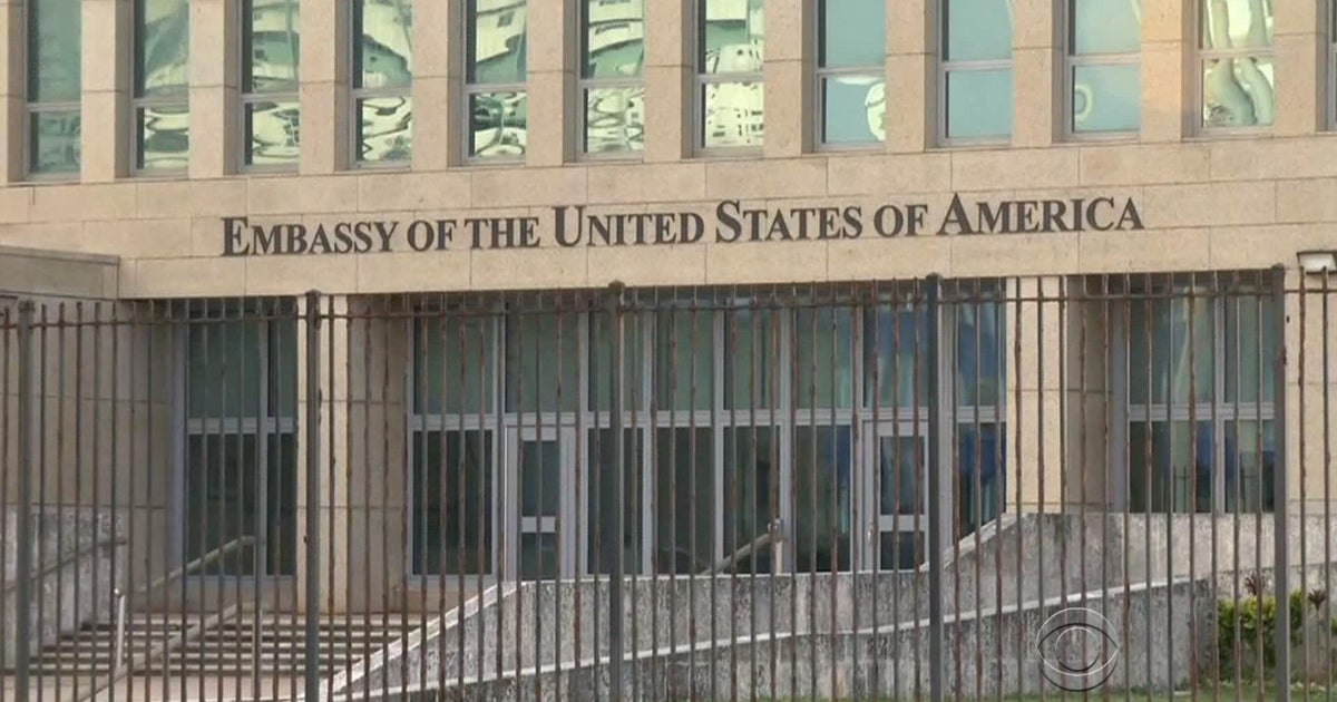Cuba health attack victims show brain abnormalities, doctors say - CBS News