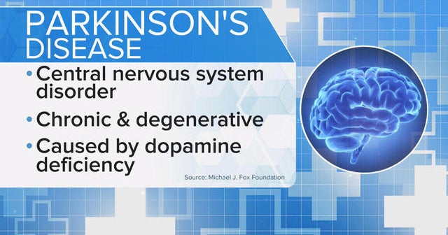 Parkinson's disease: Risk factors and slowing its progression - CBS News