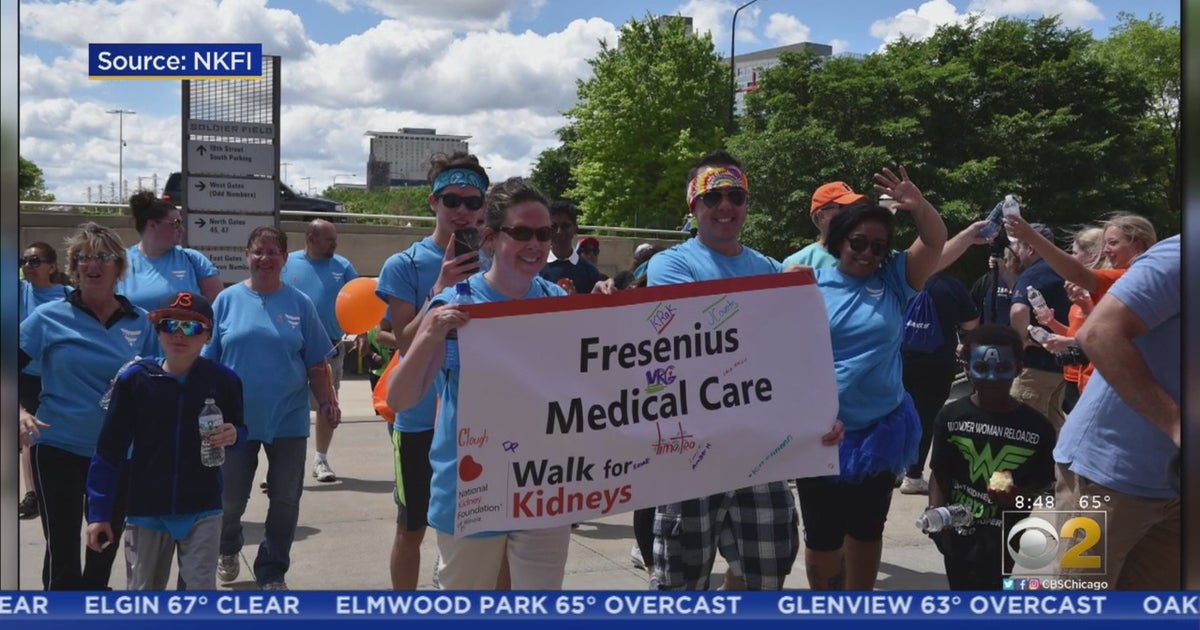 National Kidney Foundation Of Illinois To Host Walk For Kidneys Sunday ...