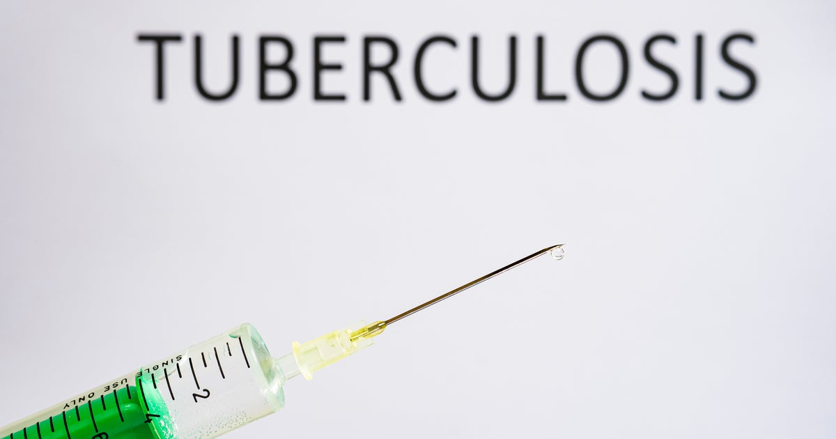 Tuberculosis Vaccine Could Mitigate Risk Of Contracting COVID-19, Study ...